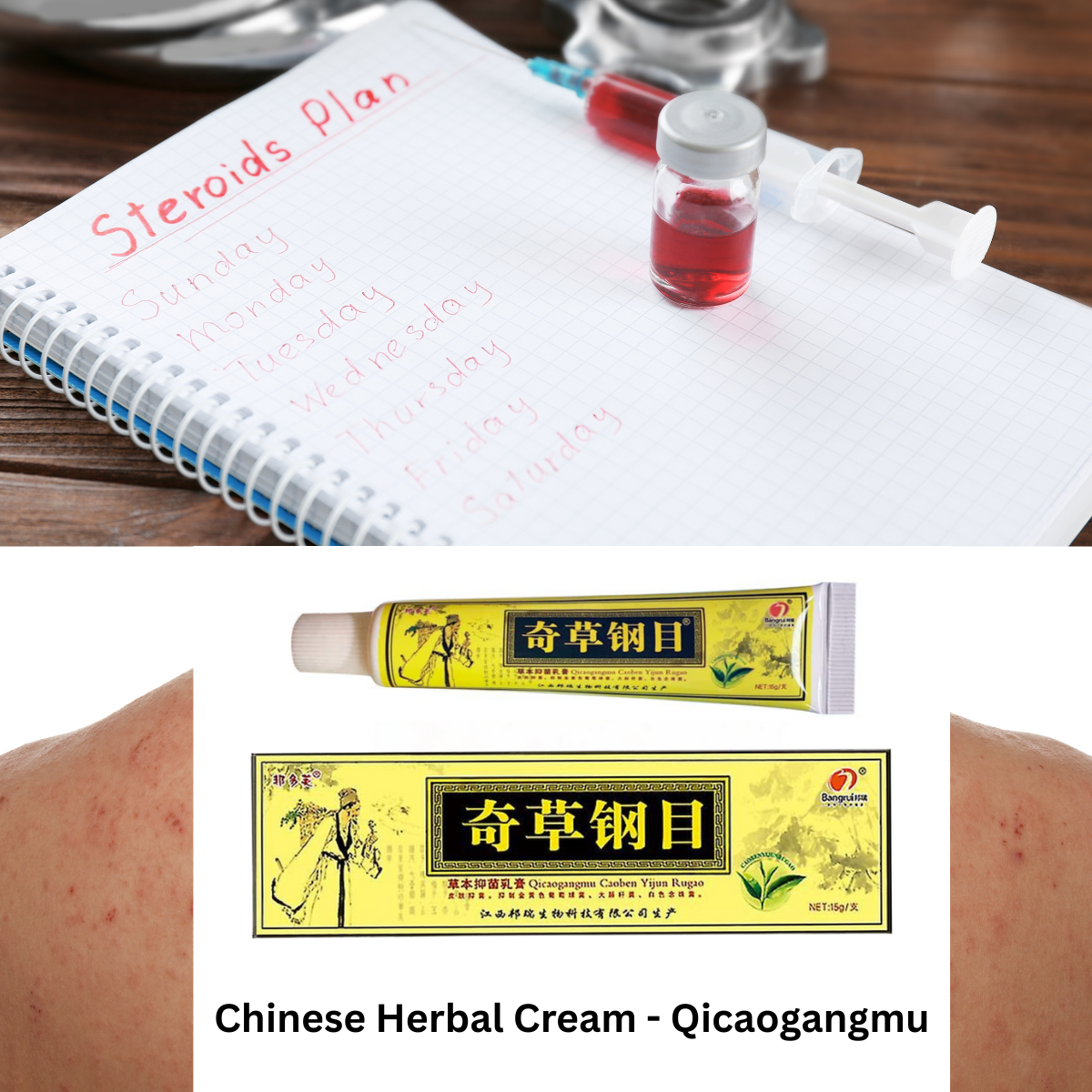 QICAOGANGMU vs. Steroid Creams: Which Is Safer in the Long Run?